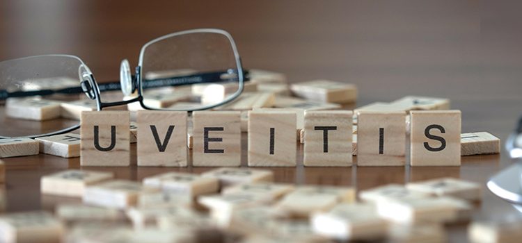 Uveitis: Diagnosis and Treatment of Inflammatory Eye Diseases - Sugoii ...